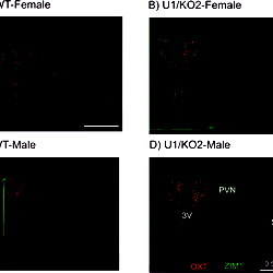 Spatial expression patterns of Zim1 within the hypothalamus of WT and ...