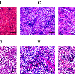 Pathological section examination.