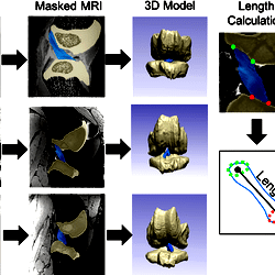 3D models were created for tissues such as the anterior cruciate ...