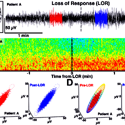 Example of activity around loss of response (LOR).