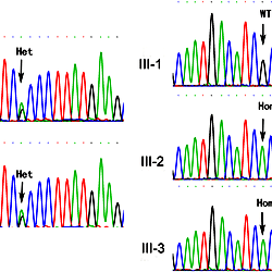 Data from Sanger sequencing for the two affected patients and the ...