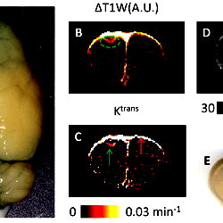 Comparison of EB staining, T1-weighted contrast enhancement, T2, and ...