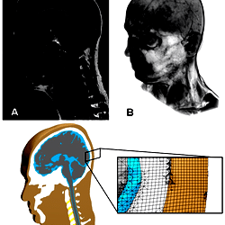 Image-based finite element model of the human head and neck.
