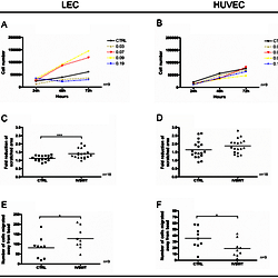 LEC and HUVEC proliferation and migration changes upon IVSWT.