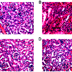 Kidney pathology.
