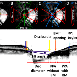Measurement of PPA lengths, tilt angles and disc diameters with ...
