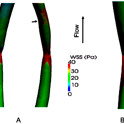 Maps of hemodynamic wall shear stress (WSS) in cuffed vessels.