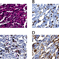 Representative IHC stain of CD3, CD4, CD8 and PD-L1.