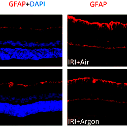 GFAP expression in the retina after unilateral IRI and Argon inhalation.