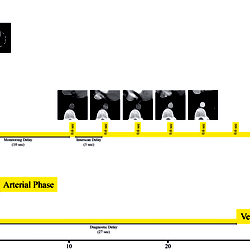 Multiphase CT scan protocol consists baseline, monitor and scan phases.