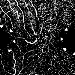 Representative images of the normal macula obtained using optical ...