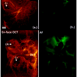 AF/OCT scans of tonsils.