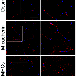 Distribution of desmin in control muscle.
