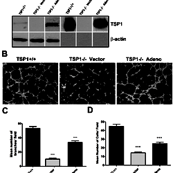 The re-expression of TSP1 in TSP1−/− ChEC.