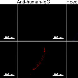 Colocalization of mAb hu2c and HSV antigens in HSV-1 KOS infected corneas.