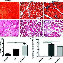 Muscle pathology in 10 month-old GM muscle of wild-type, mdx and mdx ...