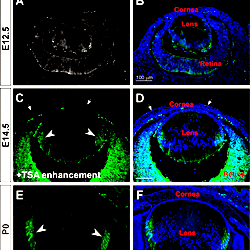 Item - Phospho-ERK (pERK) immunofluorescence in developing mouse eyes ...