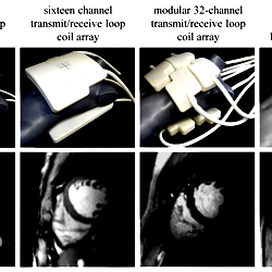 Synopsis of RF coil configurations used in this study.