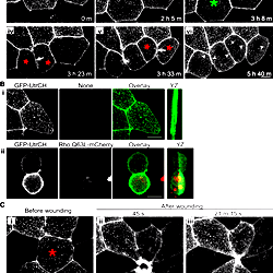 Microridge organization during cytokinesis and wounding.