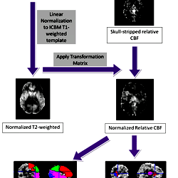 Diagram of the ASL analysis workflow.