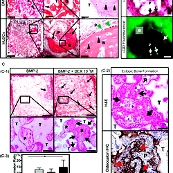 Ectopic bone formation analyses.
