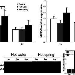 Expression of MMP-2 and MMP-9 and gelatin zymography in skin wounds.