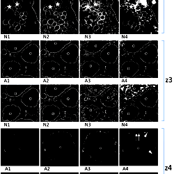 Three sets of image segmentation of the JC-1 stained ovary fragments ...