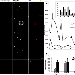 Poly(A) RNA distribution during all five diffuse stages of diplotene (A—O).