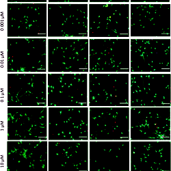 Representative images from iCell Neuron chemotherapeutic treatment.