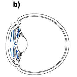 Schematic illustration of the (a) normal eye, (b) plateau iris eye, and ...