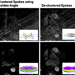 A counter-example showing that using a Golden Angle radial spoke ...