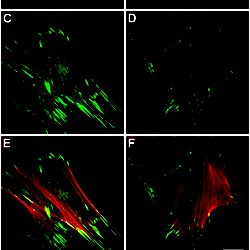 Actin cytoskeleton organization in AS and NA HBFs analyzed by ...