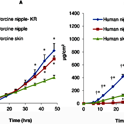 Permeation of 5-FU through excised breast tissue.