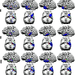 EEG, MEG and EMEG deviation scan peaks of Av10 at different propagation ...