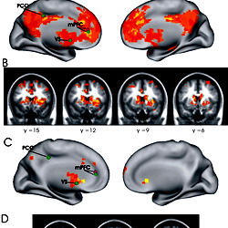 Whole-brain connectivity analysis.