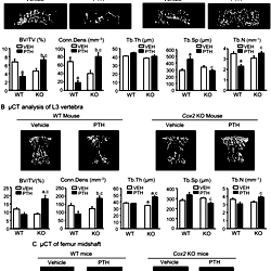 Morphometry of femoral trabecular bone and L3 vertebrae in mice infused ...