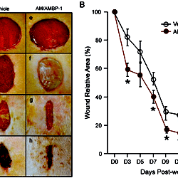 AM/AMBP-1 accelerated wound closure.