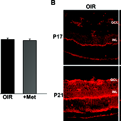 Metformin reduced the level of Flk1 in OIR mouse retinas.