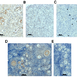 GDF9 Antibody Staining Controls.