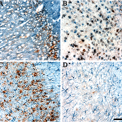 The versatility of ISH-IHC dual staining method.