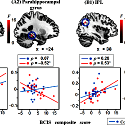 Brain regions showing a significant group difference and correlation ...