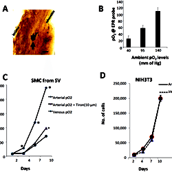Oxygen levels within the wall of SV cultured at various levels of pO2 and the impact of pO2 on ...