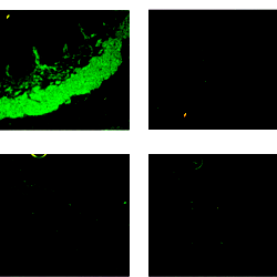 Fluorescence images of detection anti-EmA antibodies using indirect ...