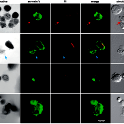 Estimation of oncosis progression by multimodal holographic microscopy.