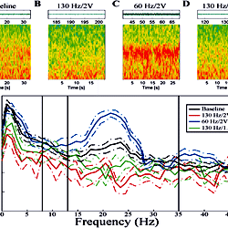 Example STN during the different stimulation sets.