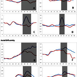 Examples of RD and AD profiles along the OR.