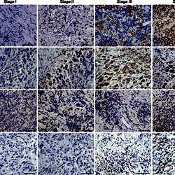 Representative immunohistochemical staining images of HIF-1α and SHH ...