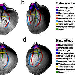 Trabecular and bilateral loops.