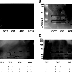 4G8 is IgL sialylated, 6E10 is Fc sialylated, and IVIG exhibits both Fc ...