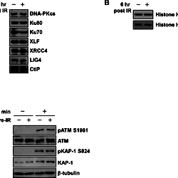 Analysis of IR-induced DNA damage signaling in cells subjected to pre-IR.